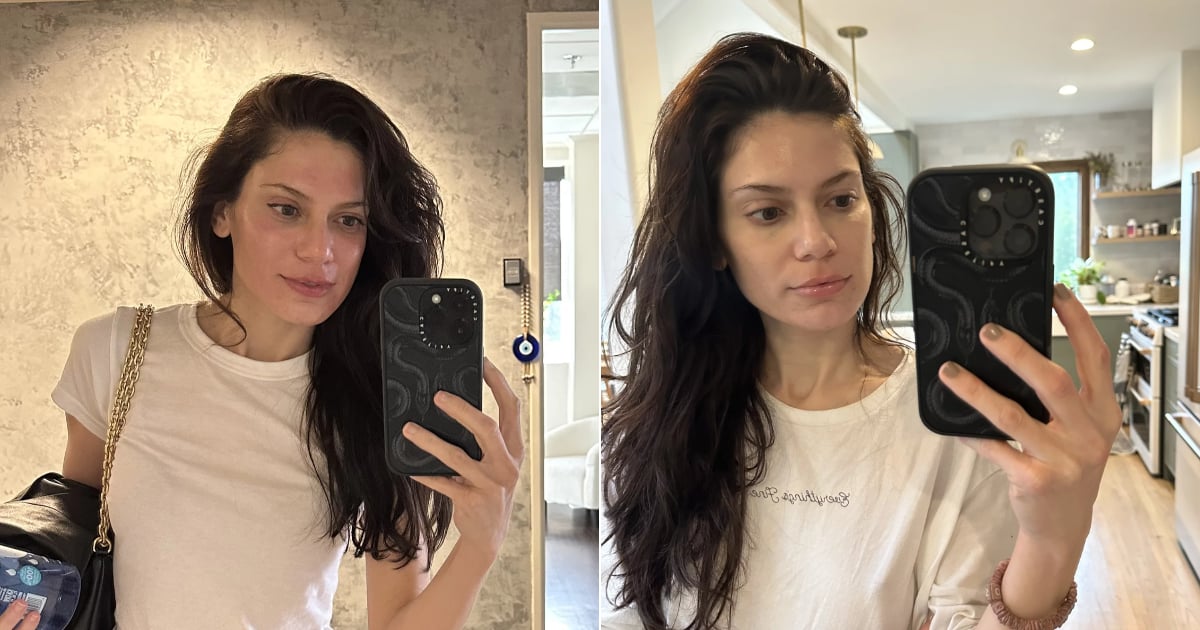 I Tried Procell Microchanneling: See Photos | PS Beauty