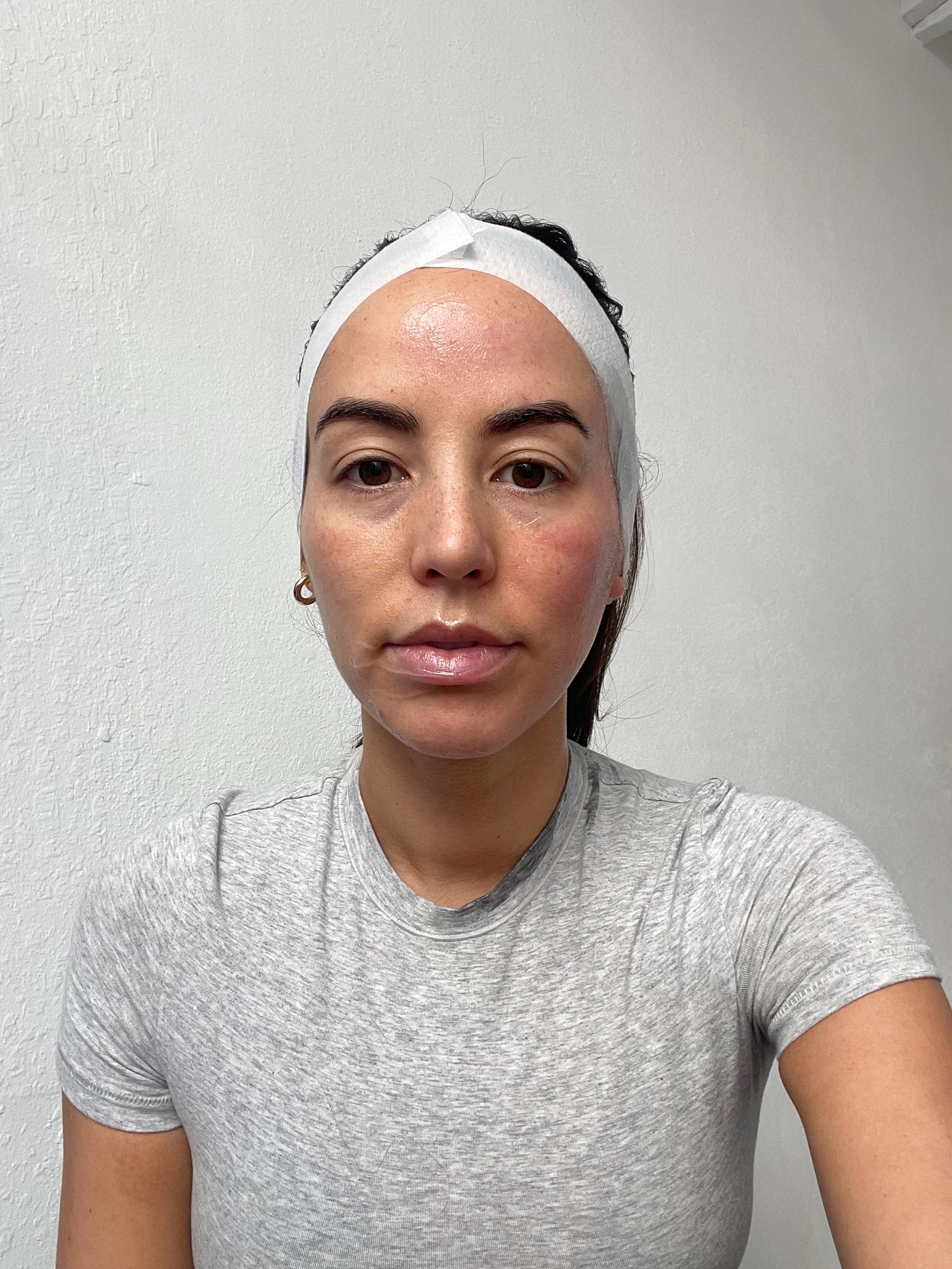 I Got a Cryo Facial: See Before and After Photos | PS Beauty