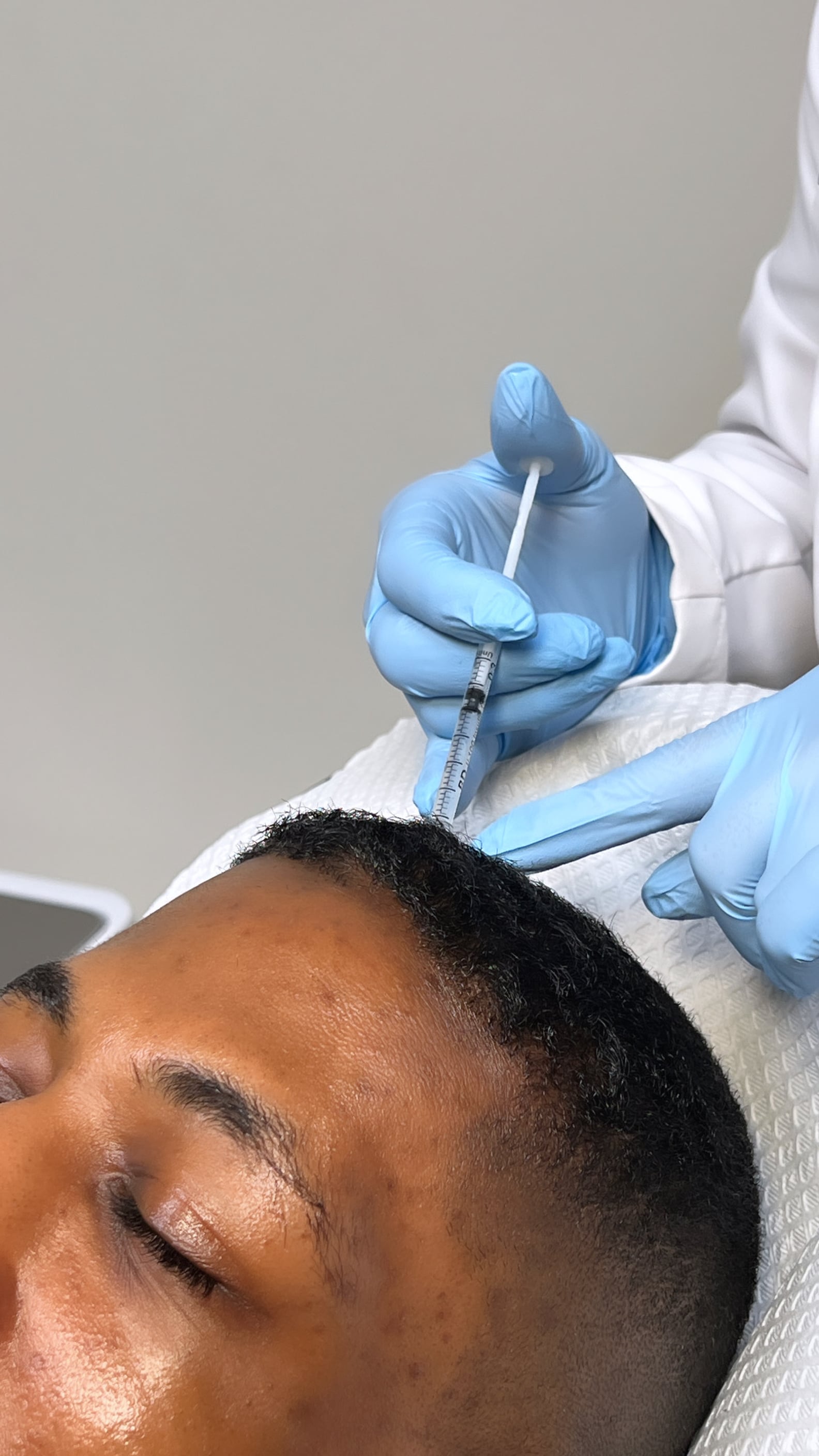 I Tried Botox For My Edges: See Photos | PS Beauty