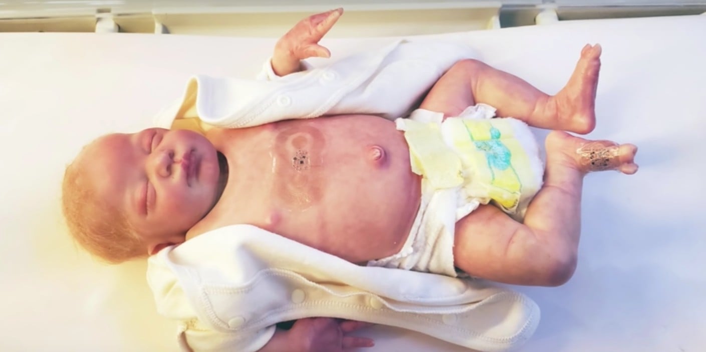 Wireless Technology For NICU Babies | POPSUGAR Family