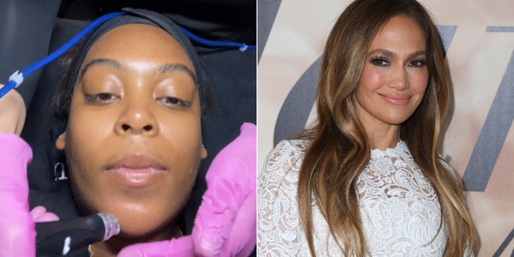 I Tried the “JLO Glow” Hydrafacial | POPSUGAR Beauty UK