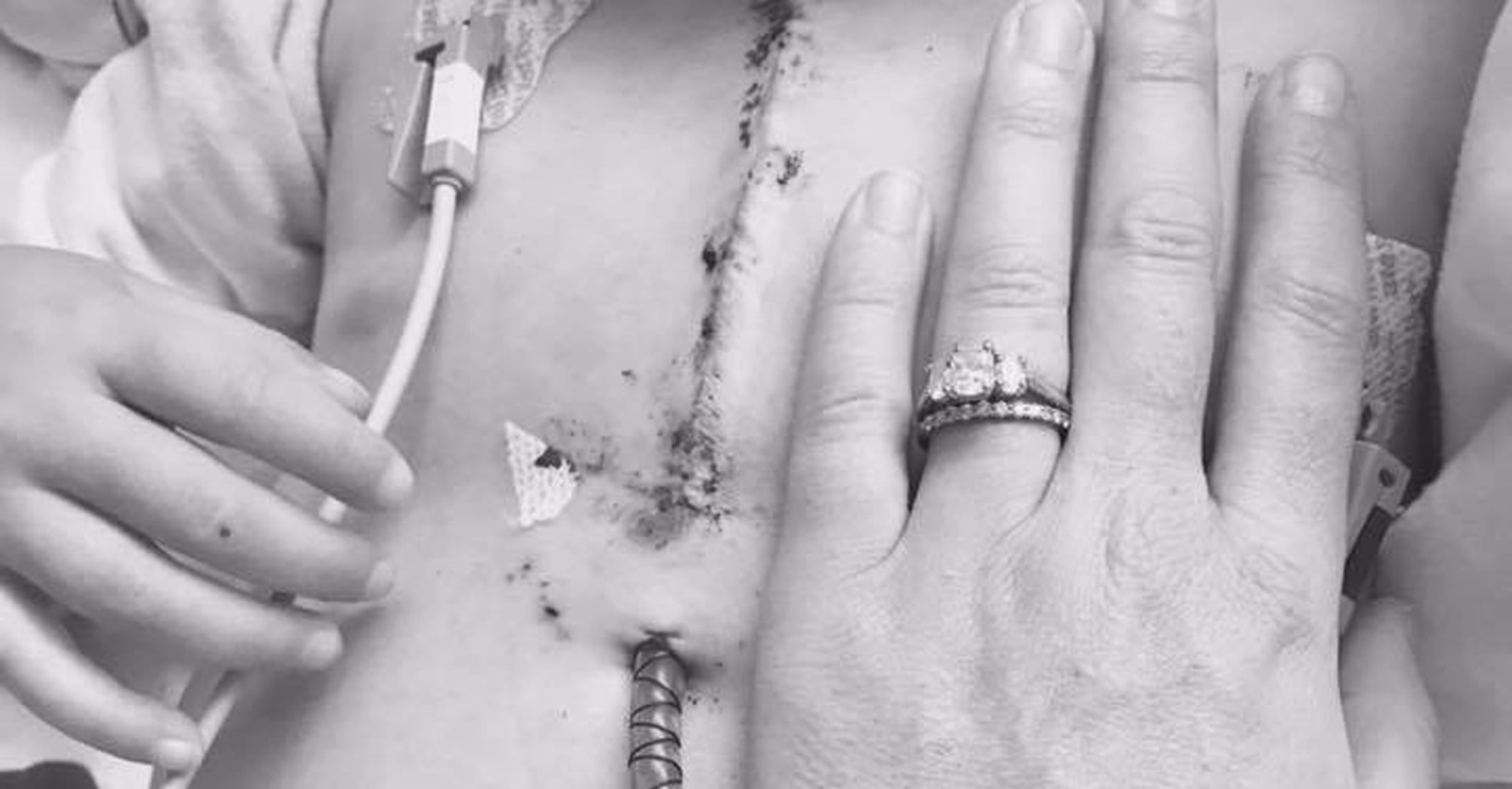 Mom Reflects on Son's Chest Scar Before Transplant Surgery | PS Family