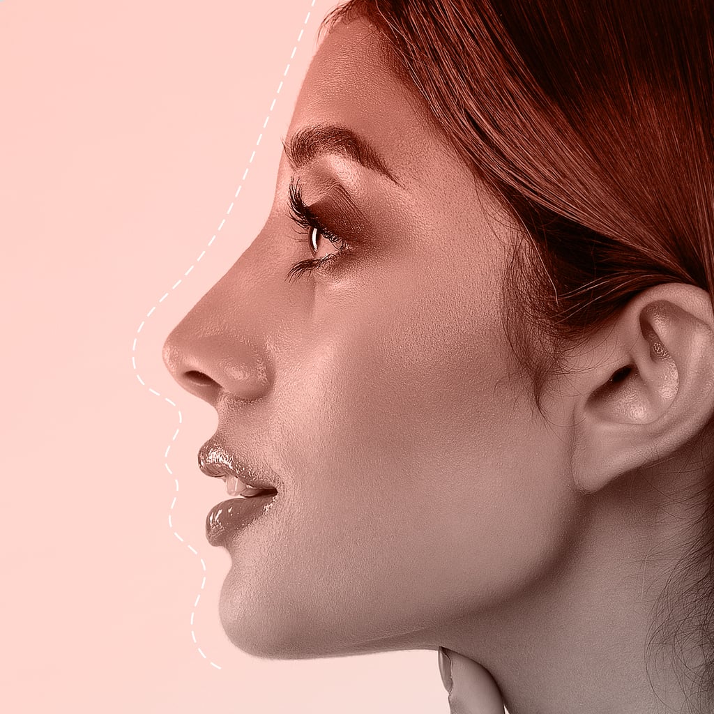 "Tip Lift" Nose Job Procedure: Recovery, Before-and-Afters | POPSUGAR ...