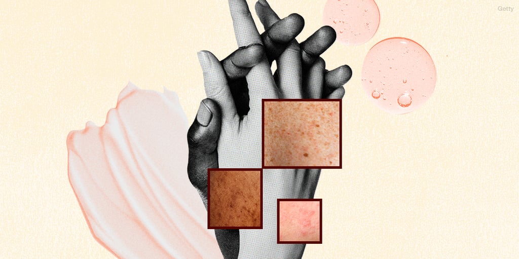 Couples Share How Skin Conditions Impact Their Relationship | PS Beauty