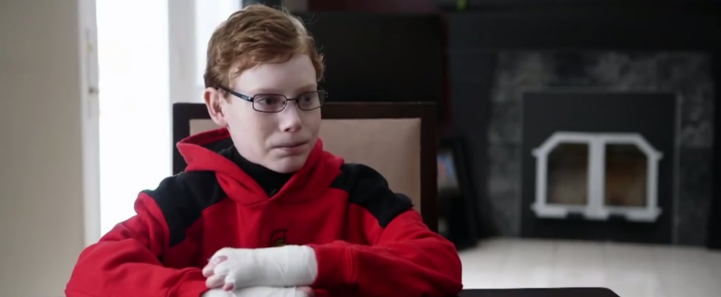 Jonathan Pitre Born With Painful "Butterfly" Skin Condition | PS Family