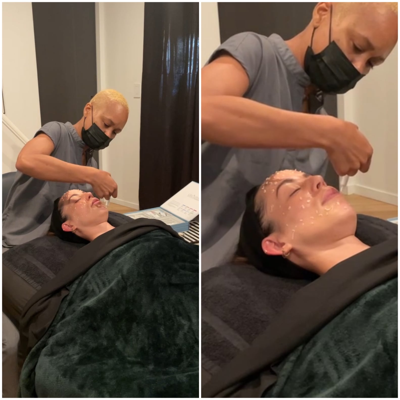 I Tried a Liquid Microneedling Treatment: See Photos | PS Beauty