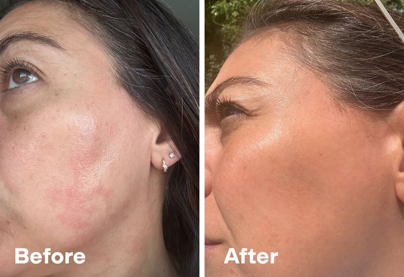 How Cerave Advanced Repair Ointment Saved My Skin | PS UK Beauty