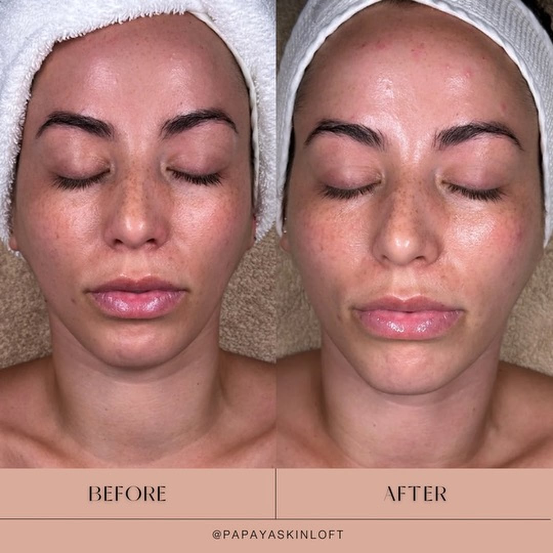 I Tried the Glo2Facial Full-Body Facial | PS Beauty