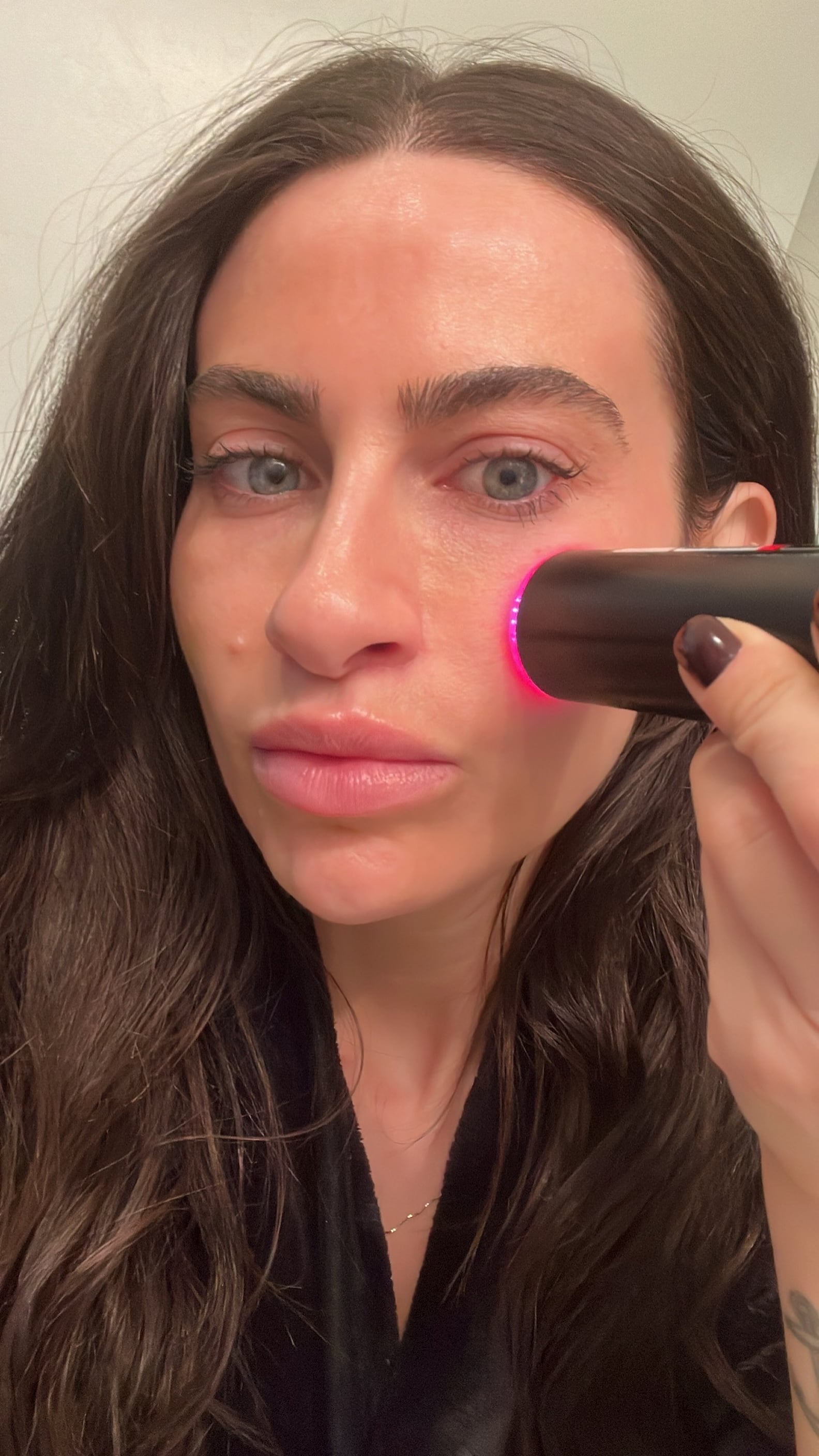 Honest Lyma Laser Review With Before and After Pictures | PS UK Beauty