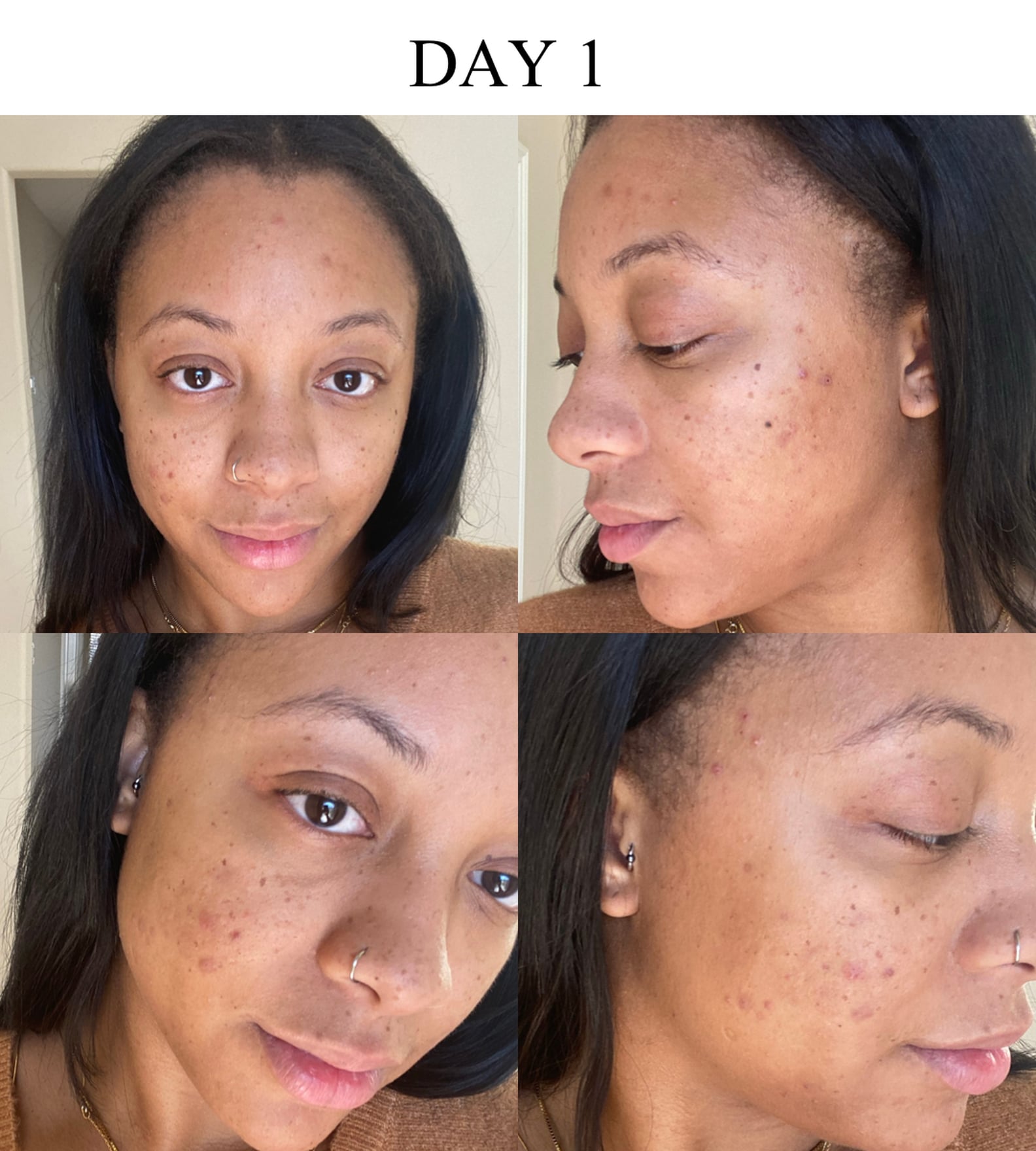 I Tried a K-Beauty 10-Step Skin-Care Routine For a Month | PS Beauty