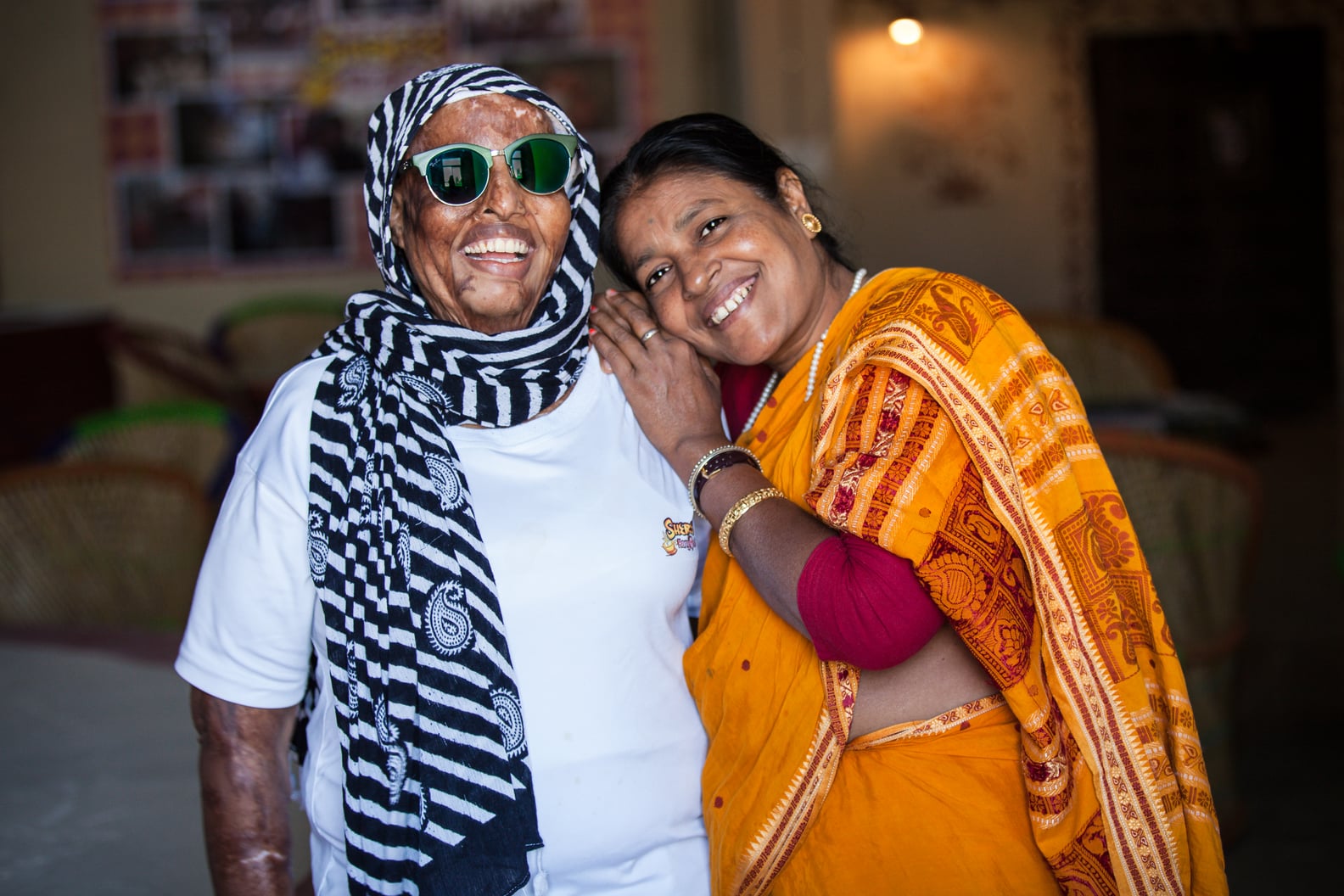 Acid Attack Survivor Story | PS News