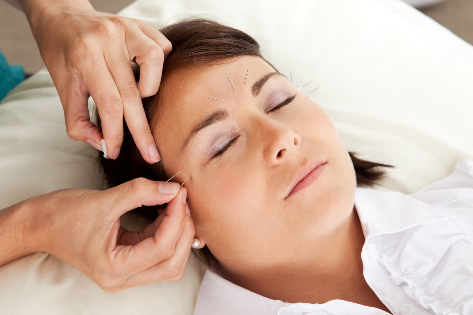 Skin Care Benefits of Acupuncture | PS Beauty