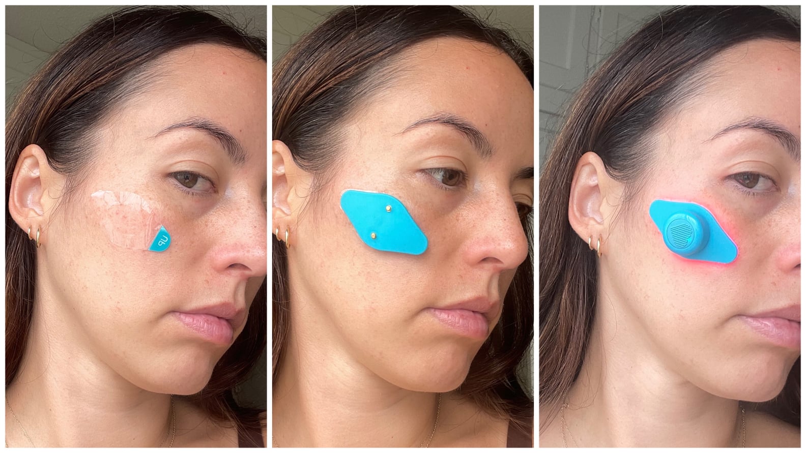 Riki Love Riki Miracle LED Patch Review With Photos | PS Beauty