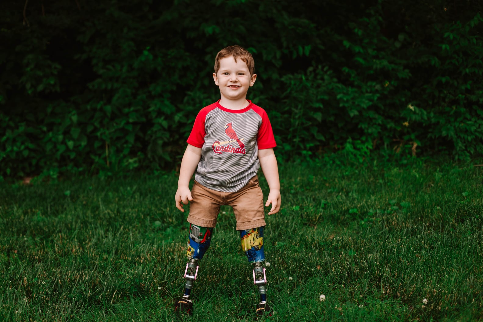 Photo Shoot of Toddler Who Lost Both Legs | POPSUGAR Family