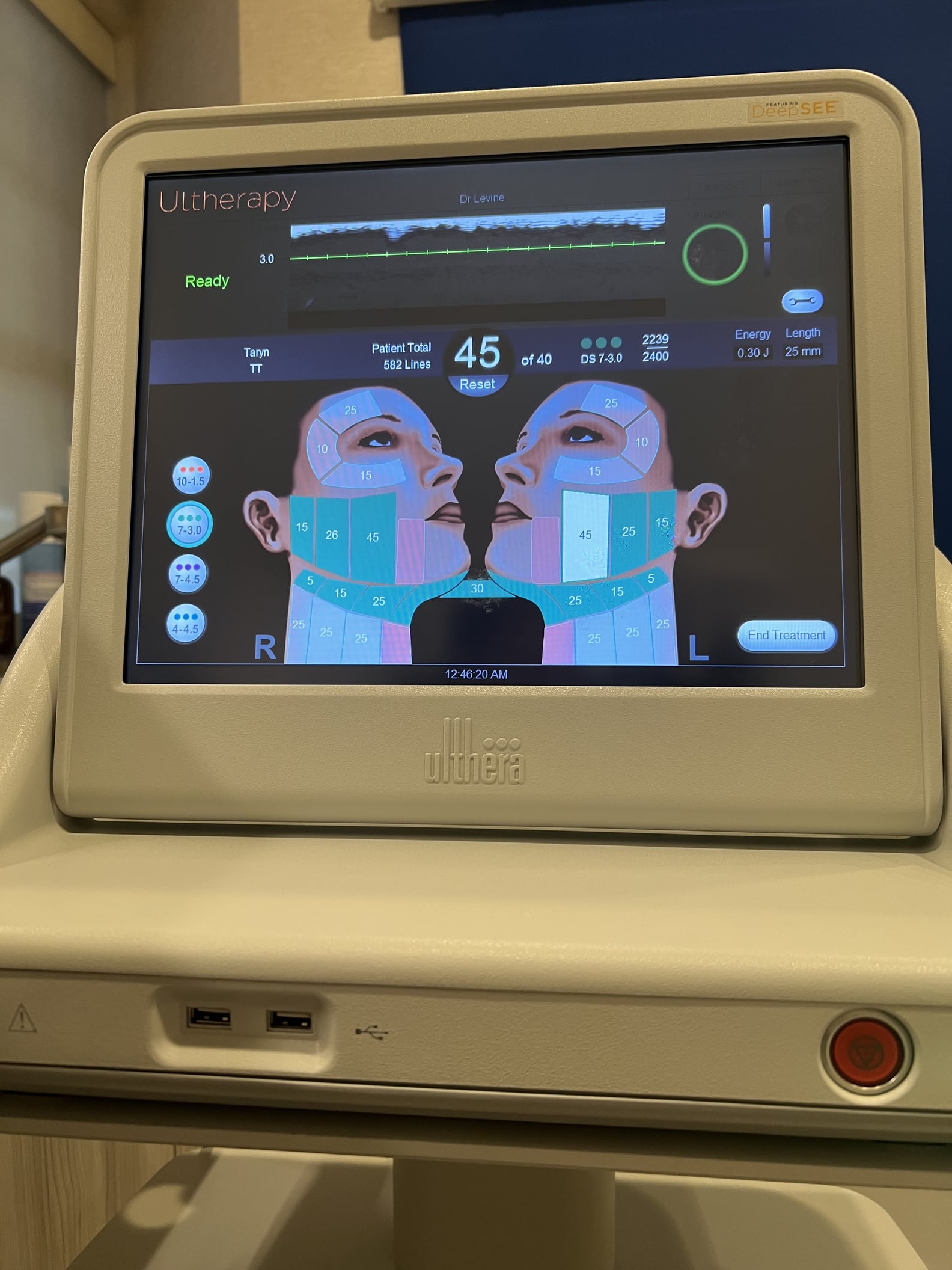 Ultherapy Before and After: Read This Editor's Full Review | PS Beauty