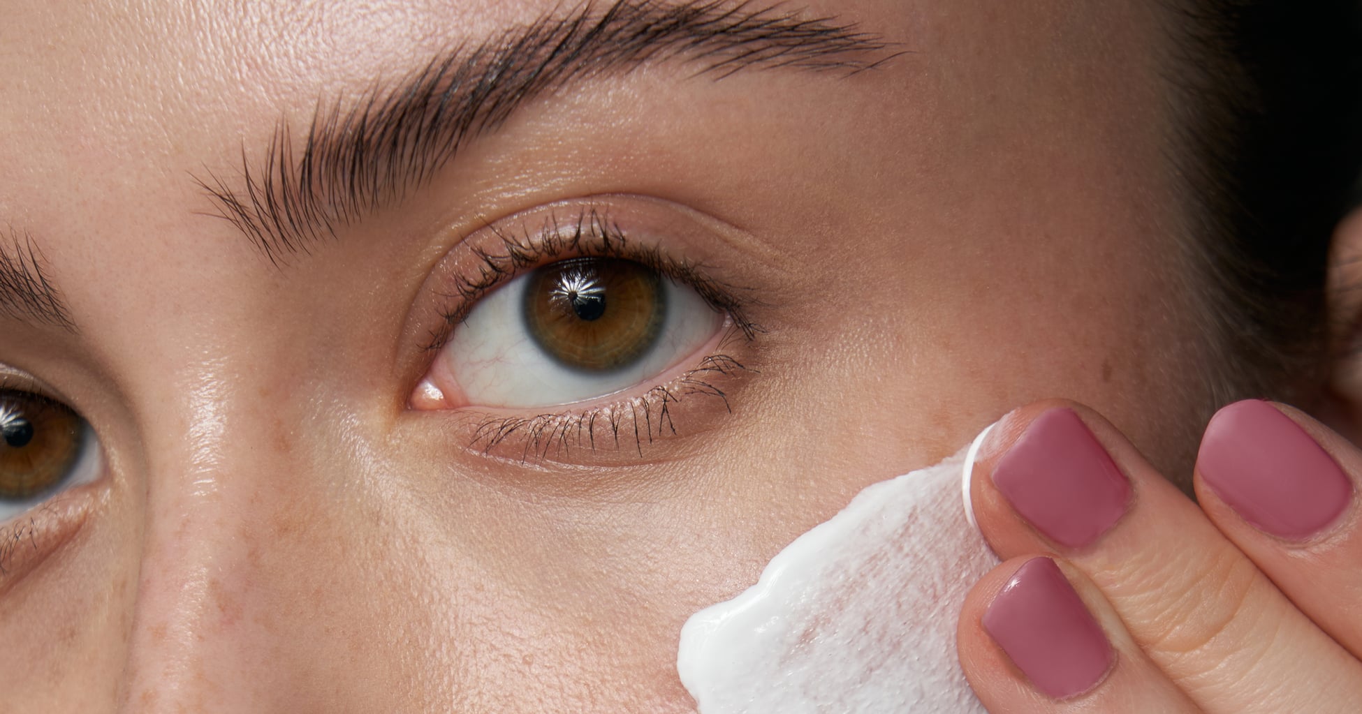 How to Get Rid of Hyperpigmentation, According to the Pros | PS Beauty