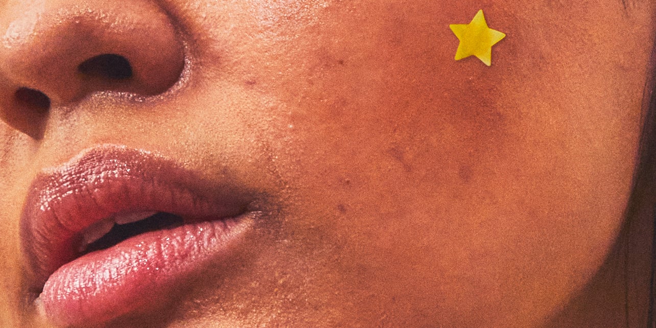 How to Get Rid of Pimples Under the Skin | POPSUGAR Beauty