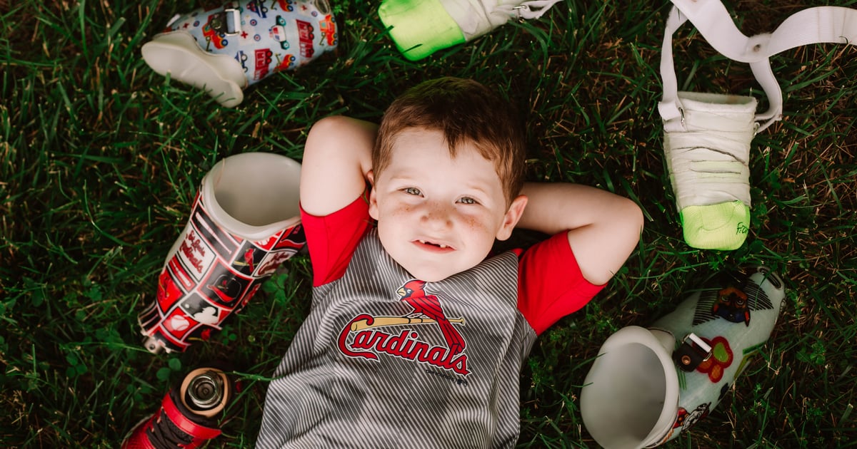 Photo Shoot of Toddler Who Lost Both Legs | POPSUGAR Family