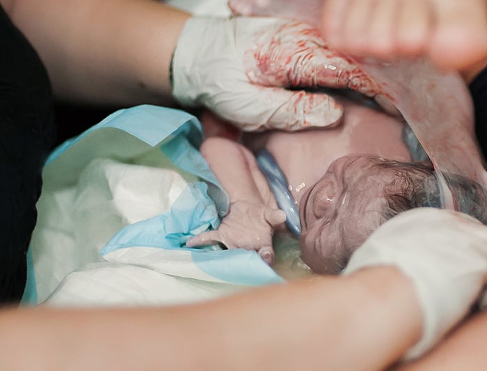 Photo Of Baby Born En Caul In Amniotic Sac POPSUGAR Family