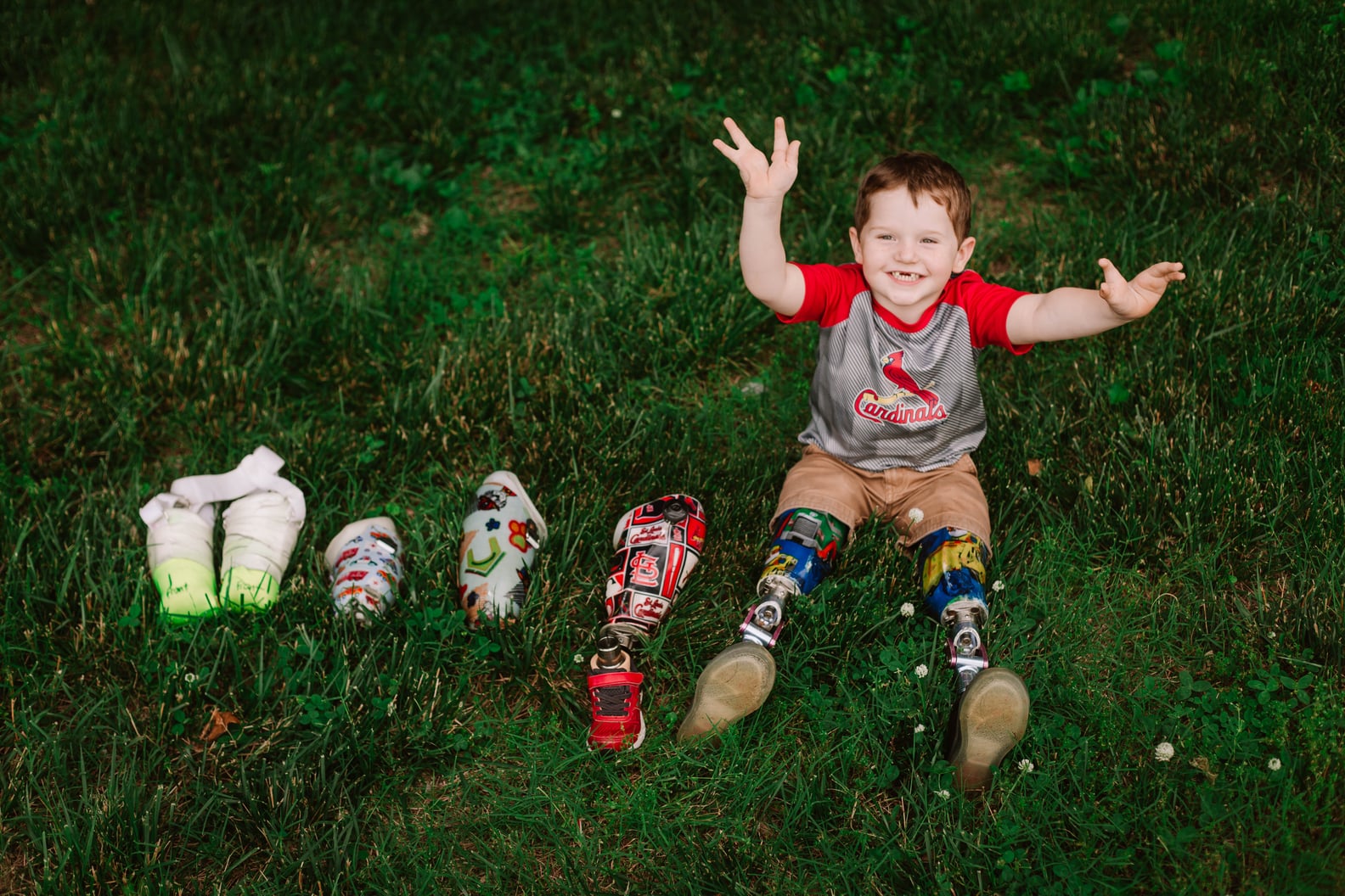Photo Shoot of Toddler Who Lost Both Legs | PS Family