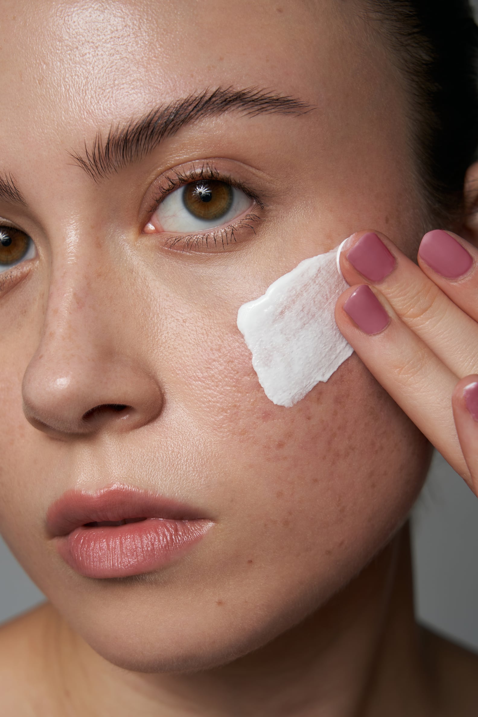 How to Get Rid of Hyperpigmentation, According to the Pros | PS Beauty