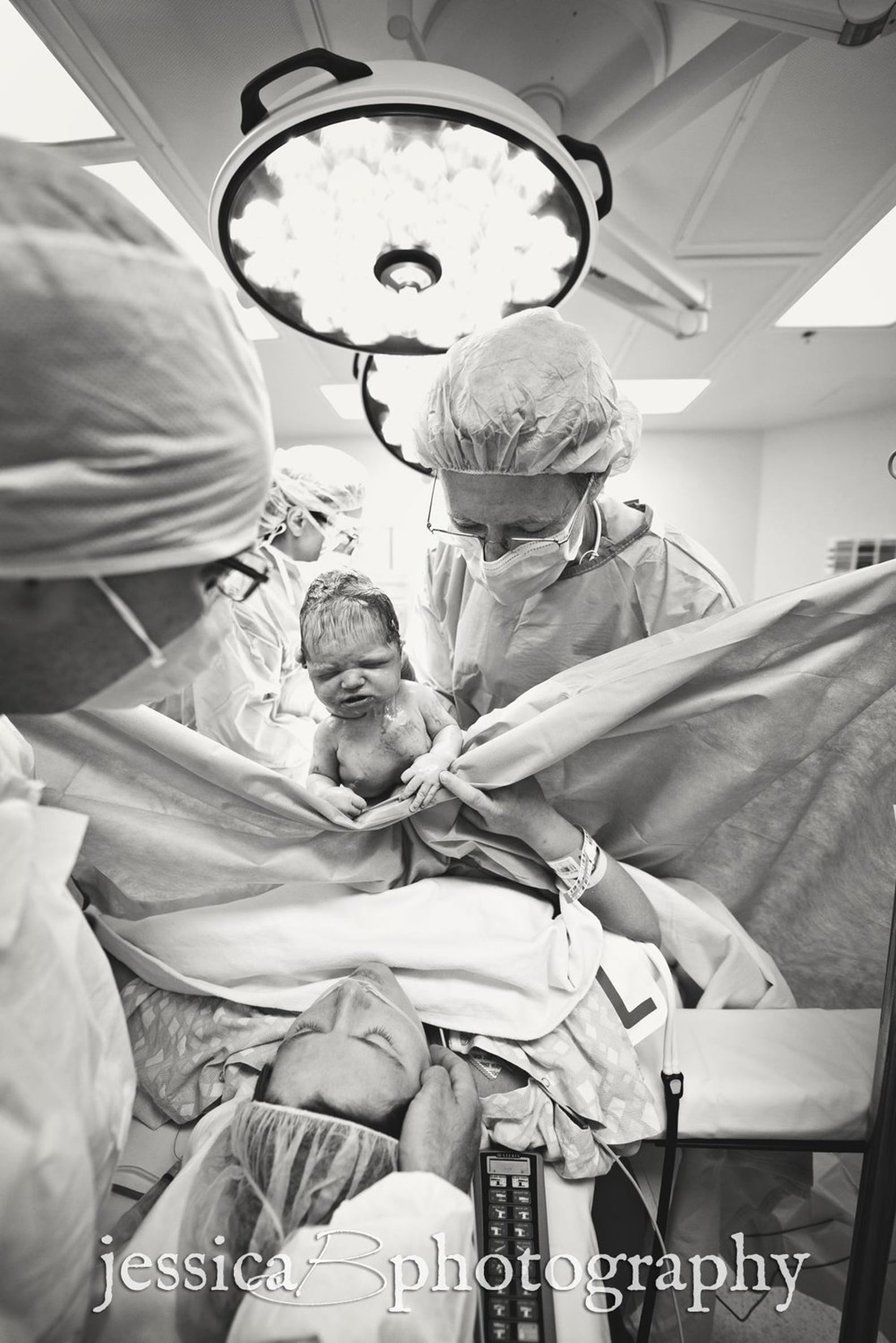 C-Section Birth Photography | PS Family