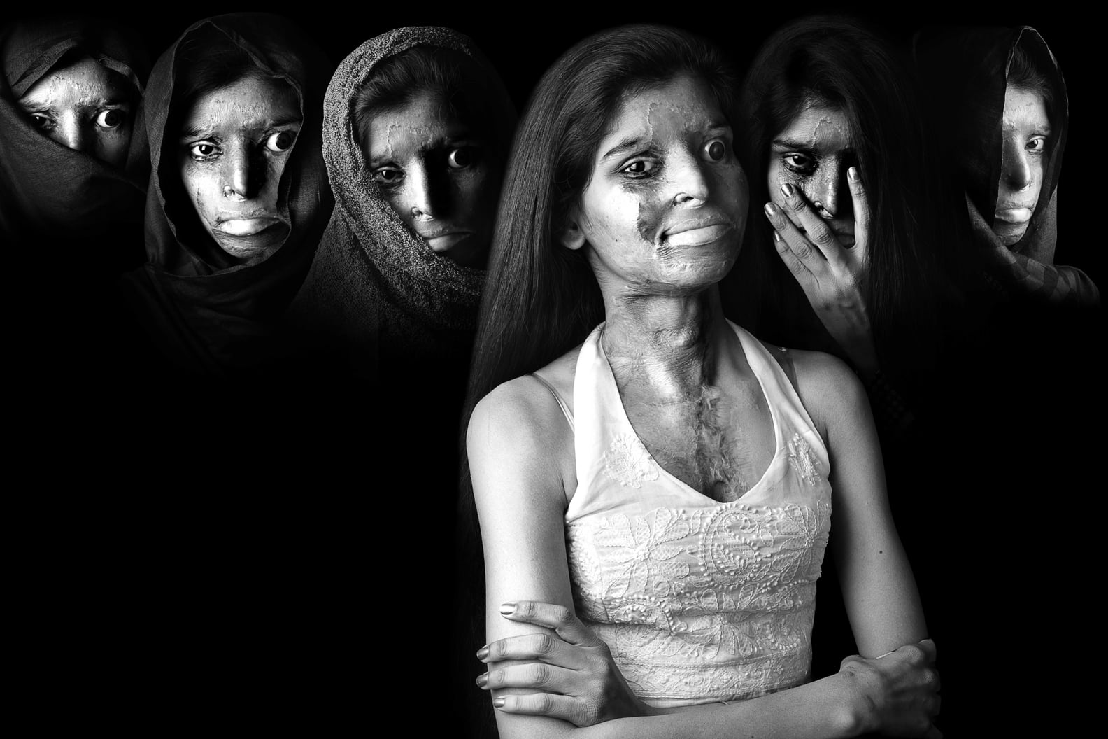 Acid Attack Survivor Portrait Series | Niraj Gera | POPSUGAR Beauty