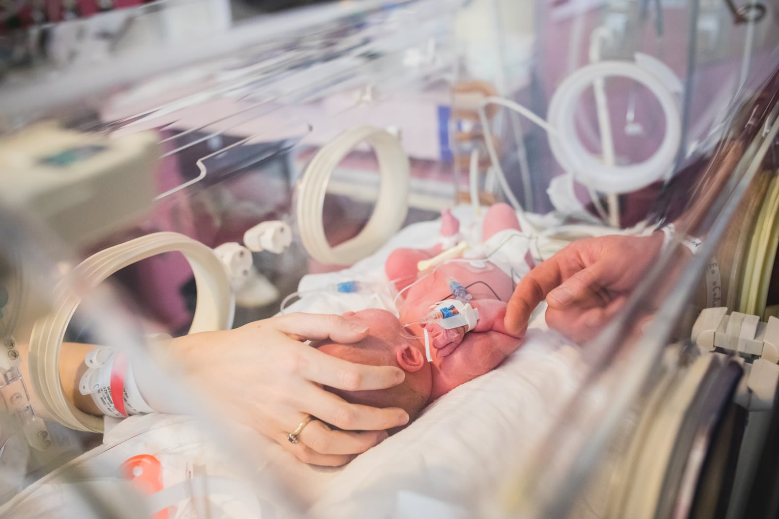 Premature Delivery Birth Photos | POPSUGAR Family