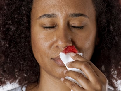 4 Ways to Stop Severe Nosebleeds That Actually Work | POPSUGAR Fitness