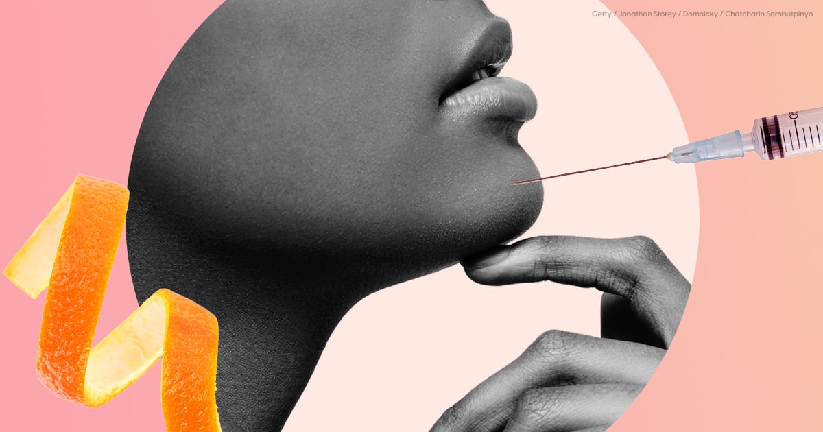 Why I Got Botox For My Dimpled Chin | POPSUGAR Beauty