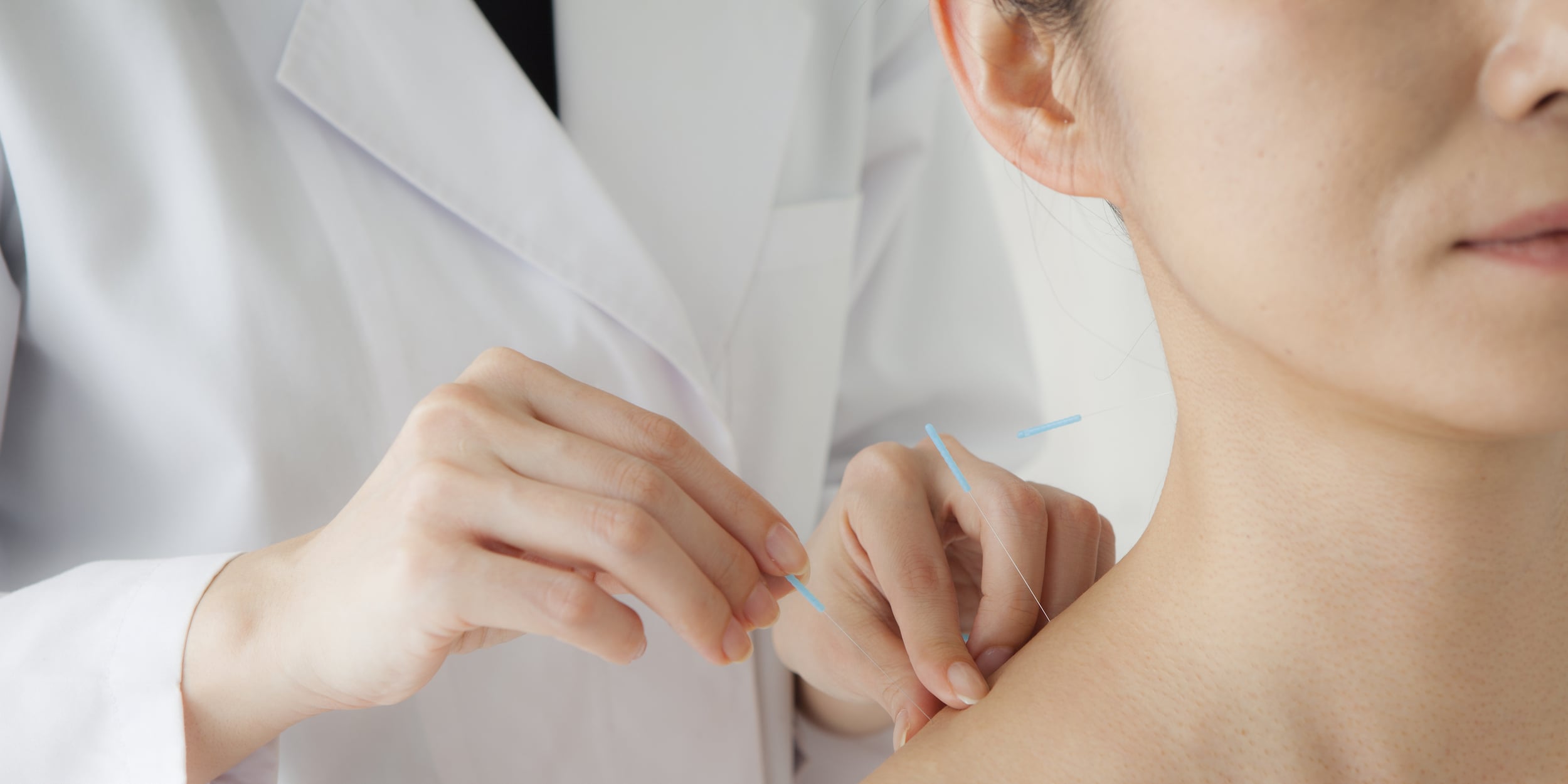 Acupuncture Side Effects to Know About Before Your Treatment | PS Fitness