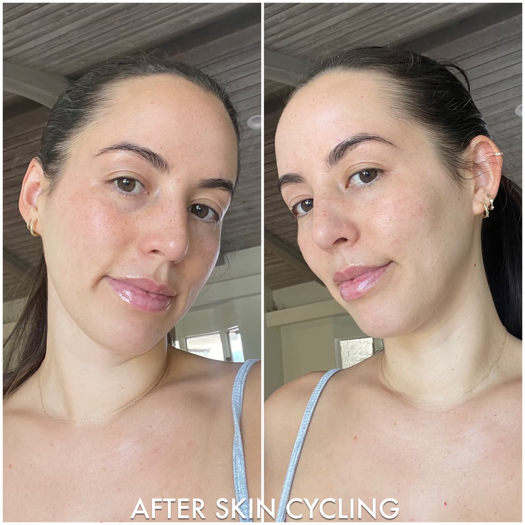 I Tried Skin Cycling on Acne-Prone Skin: See Photos | POPSUGAR Beauty UK