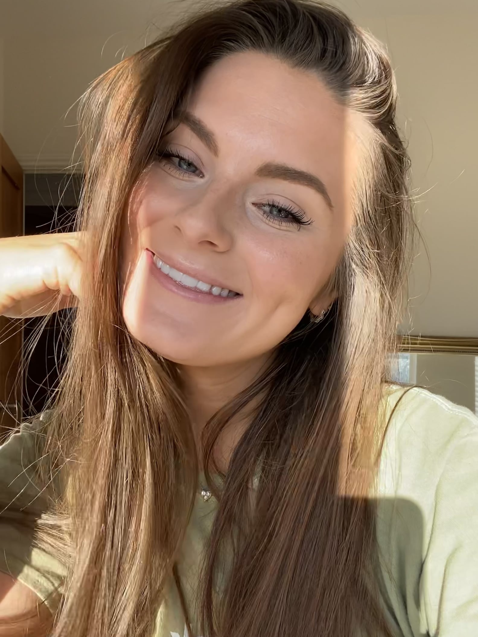 What Is Composite Bonding and Veneers? See the Photos | PS Beauty