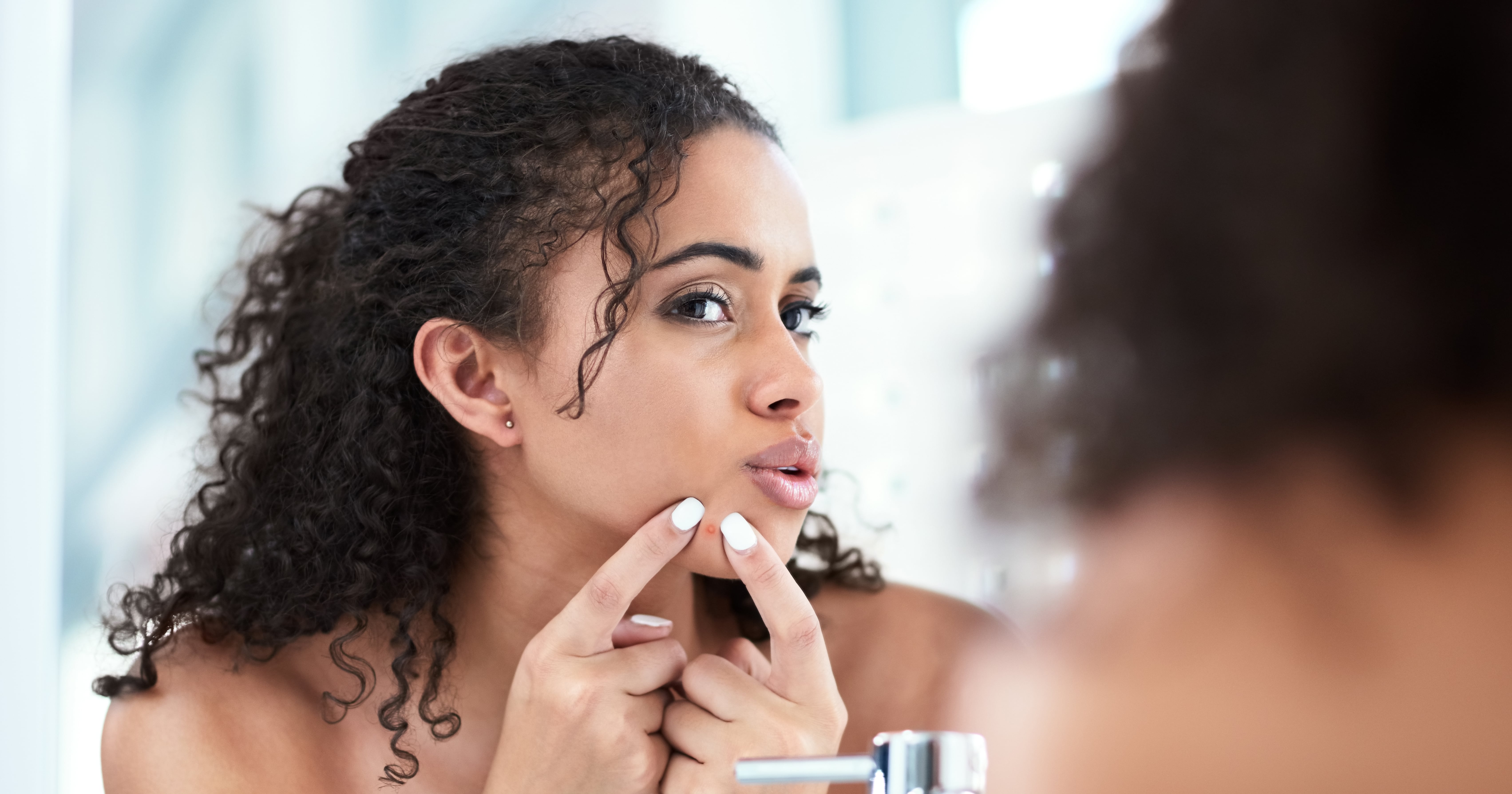 What Is Fungal Acne? How to Treat This Common Acne | POPSUGAR Beauty