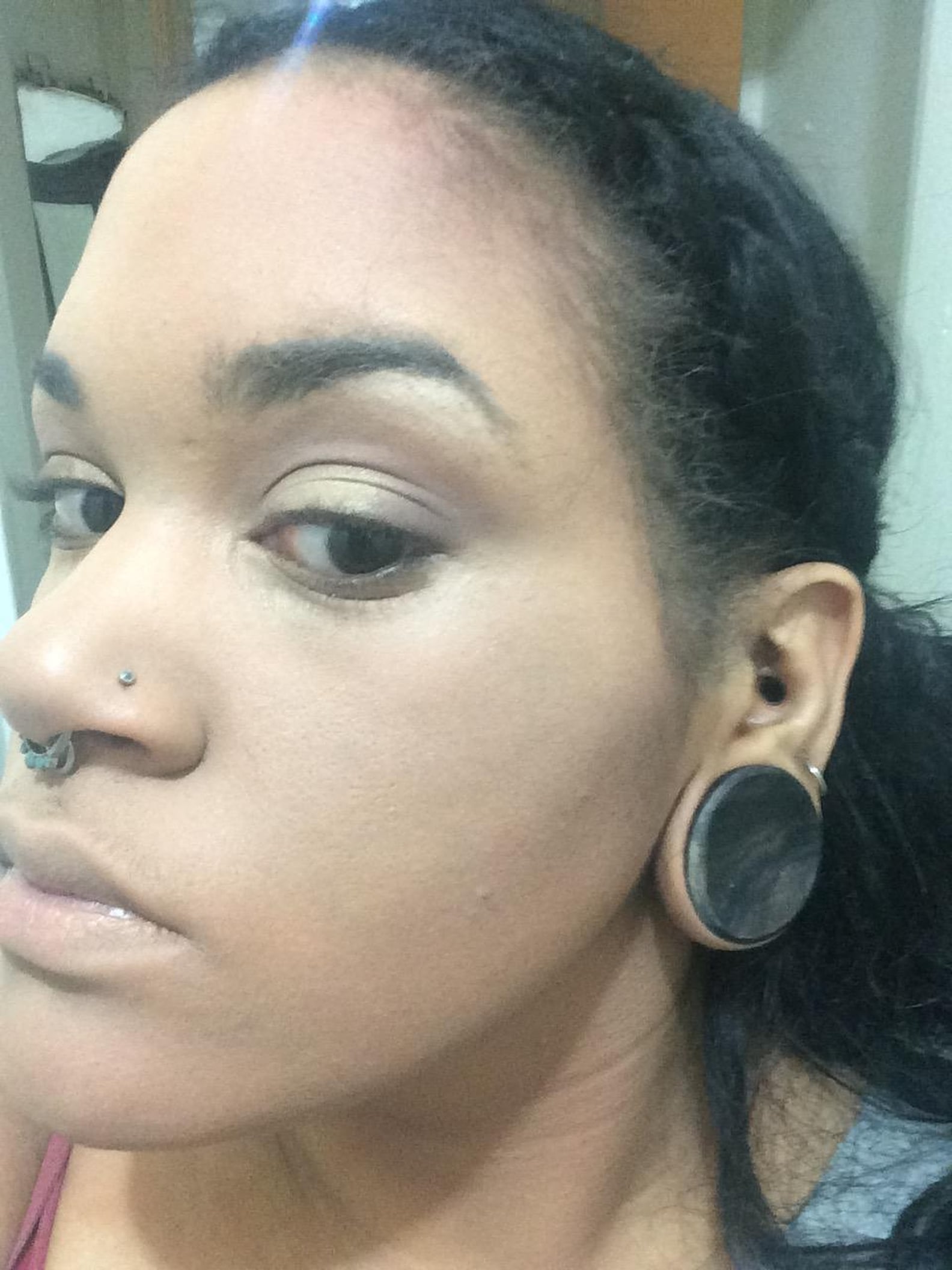 Color-Correcting Acne Scars Before and After | PS Beauty