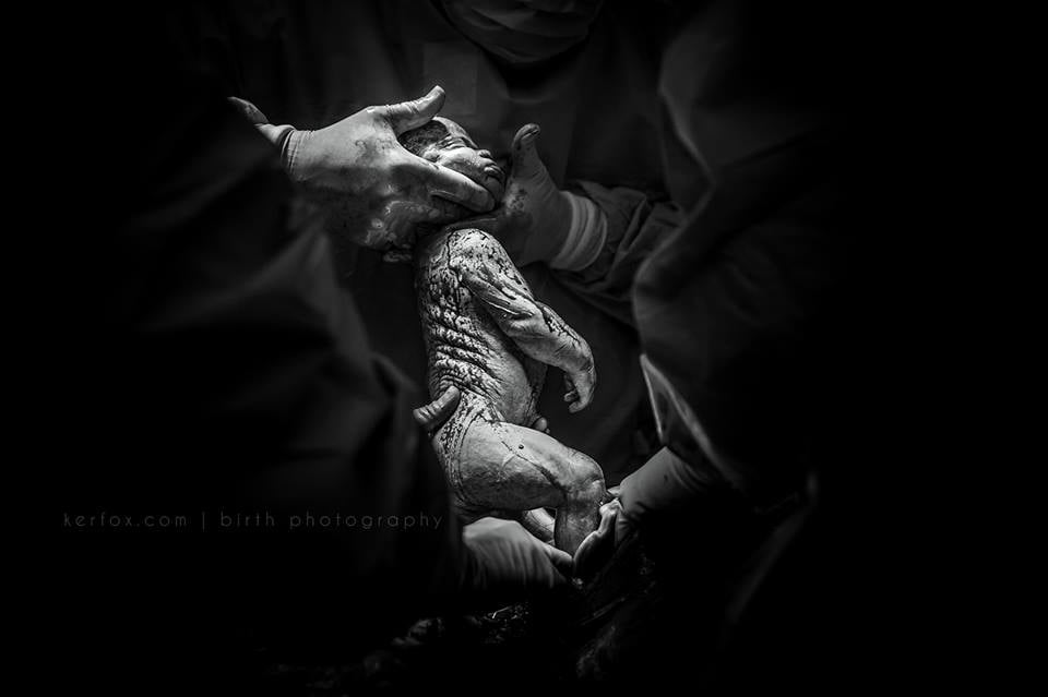 Best Birth Photos 2016 | POPSUGAR Family