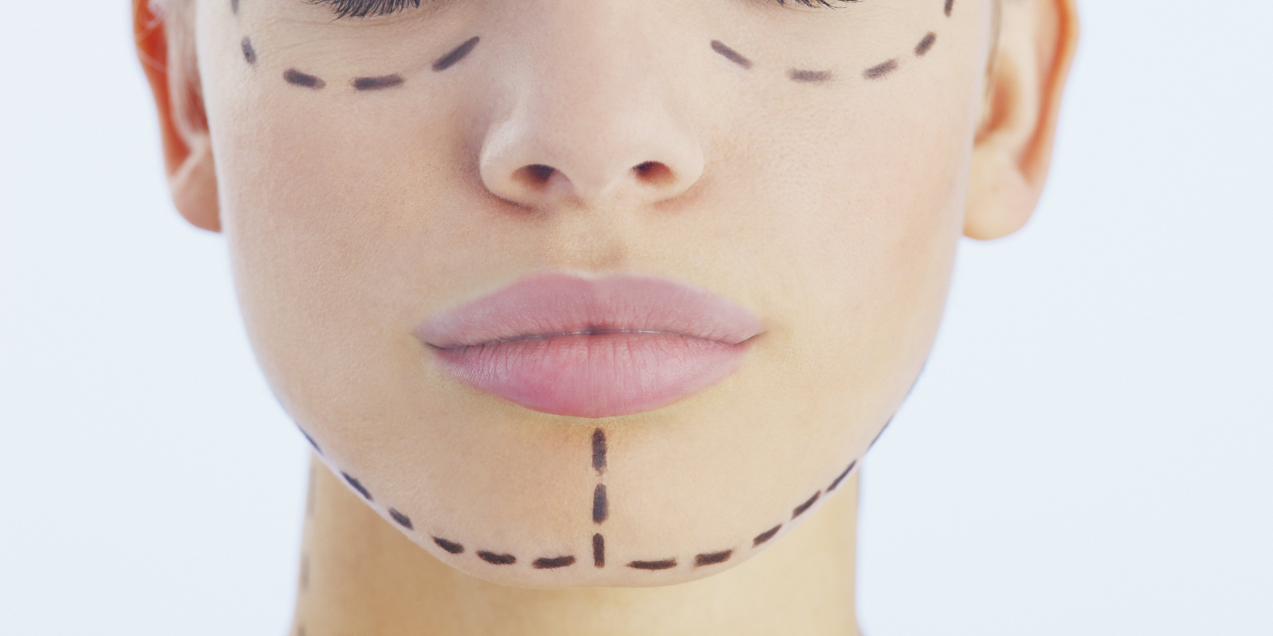 What to Know About Chin Augmentation, From a Plastic Surgeon | POPSUGAR ...