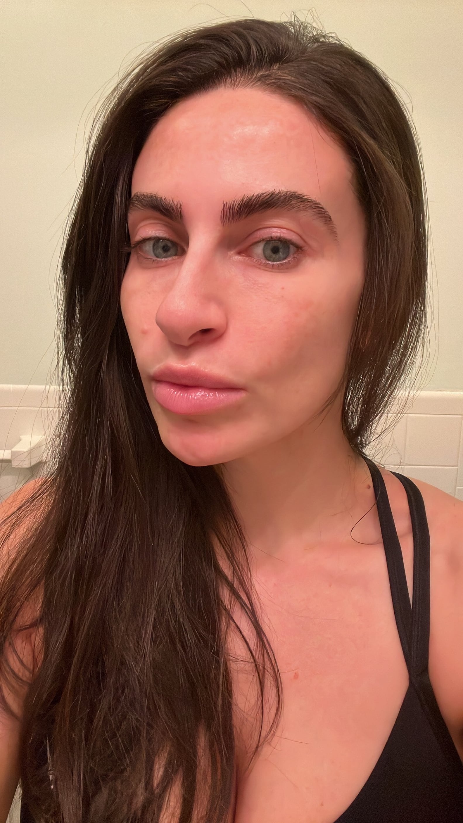 I Tried Emface, the Needle-less Skin Treatment | PS Beauty
