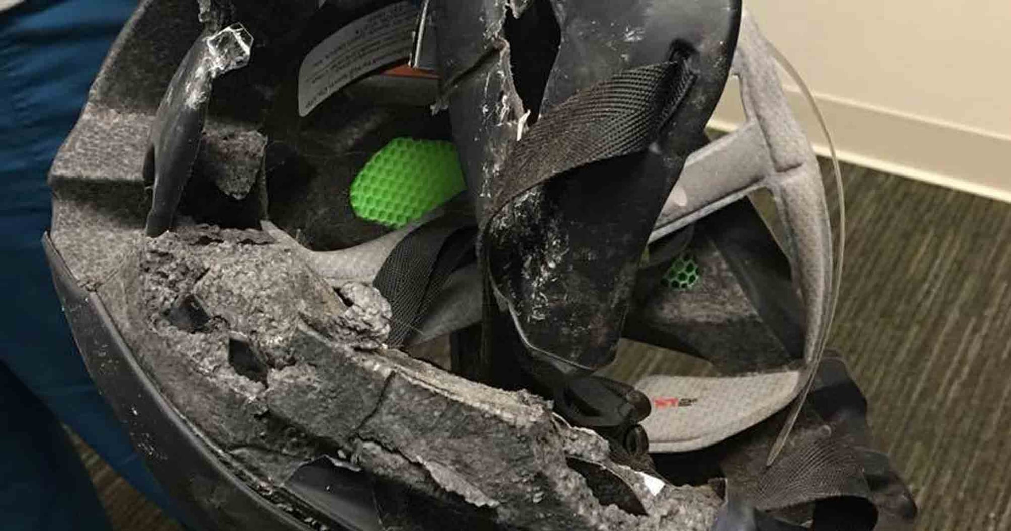 Pediatrician's Warning About Wearing a Helmet | PS Family