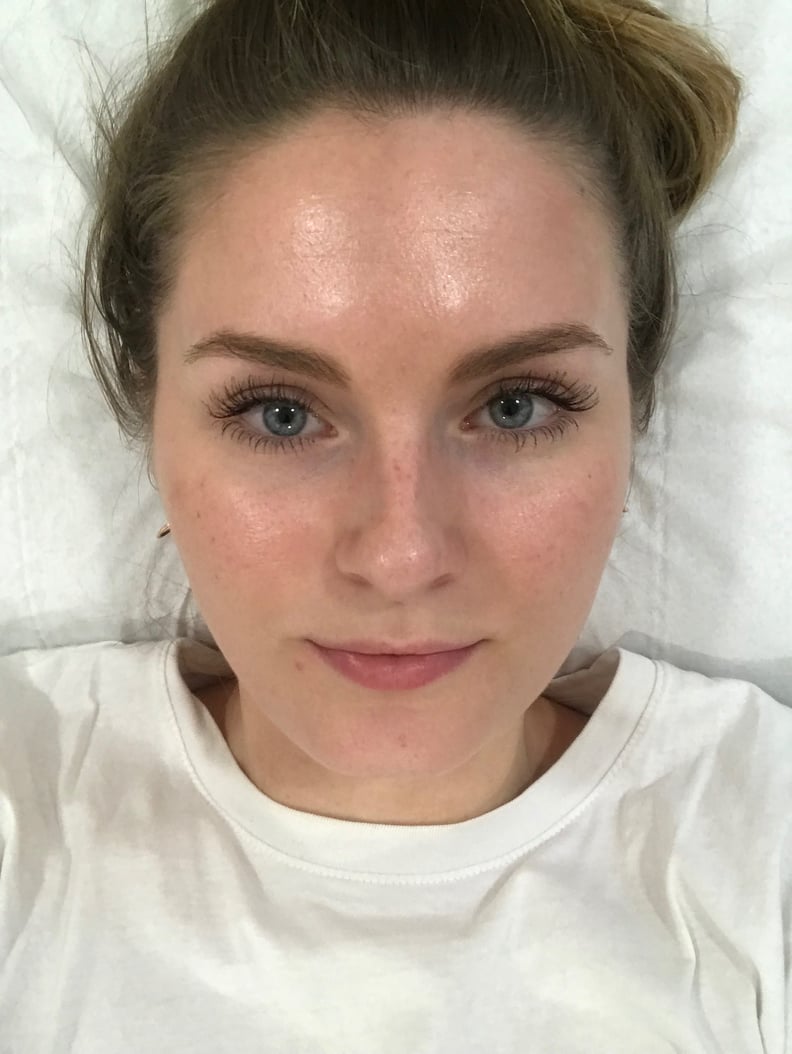 How to Treat Broken Capillaries on the Face | PS UK Beauty