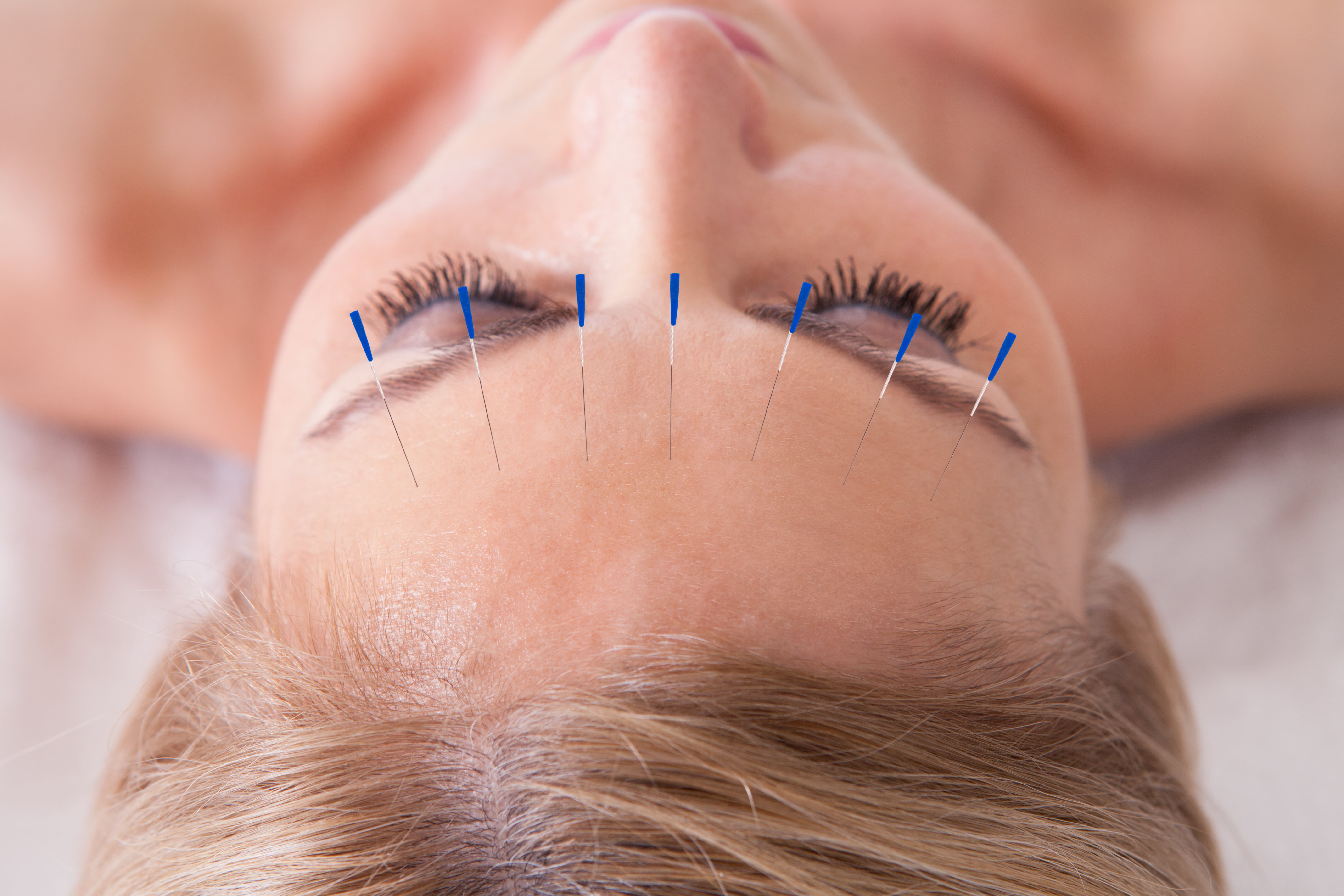 Skin Care Benefits of Acupuncture | PS Beauty