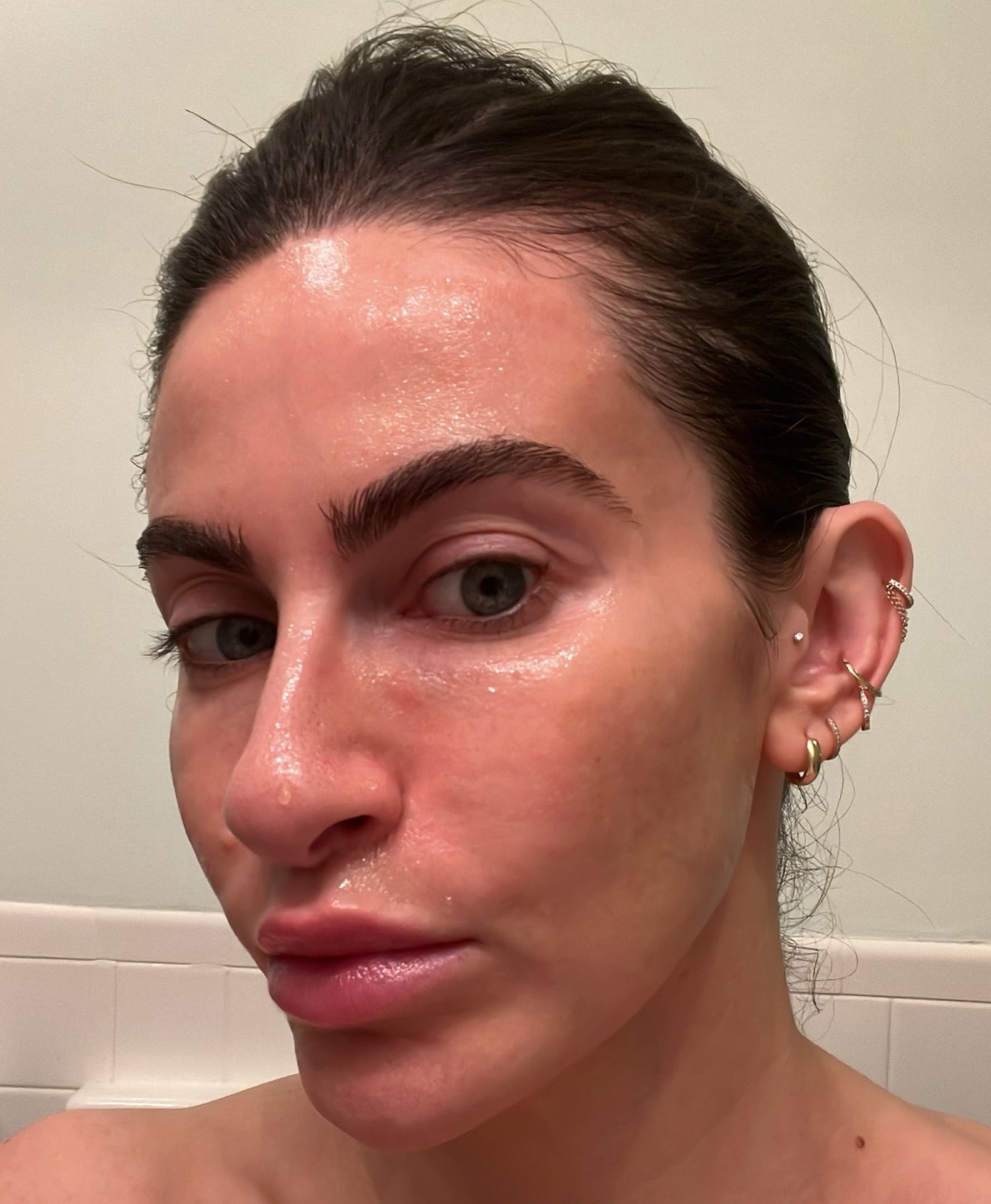U Beauty Resurfacing Flash Peel Review With Photos | PS Beauty