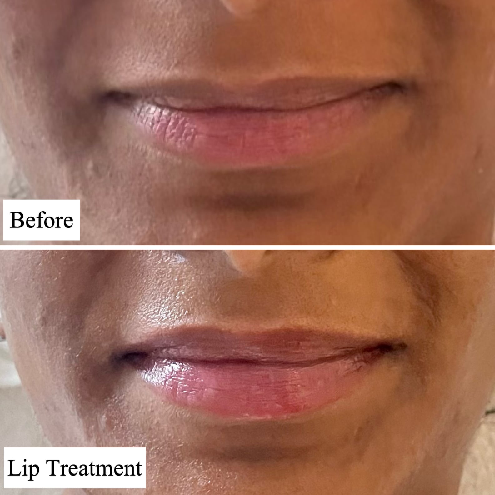 Dr. Dennis Gross DermInfusions Lip Treatment Review With Pic | PS UK Beauty