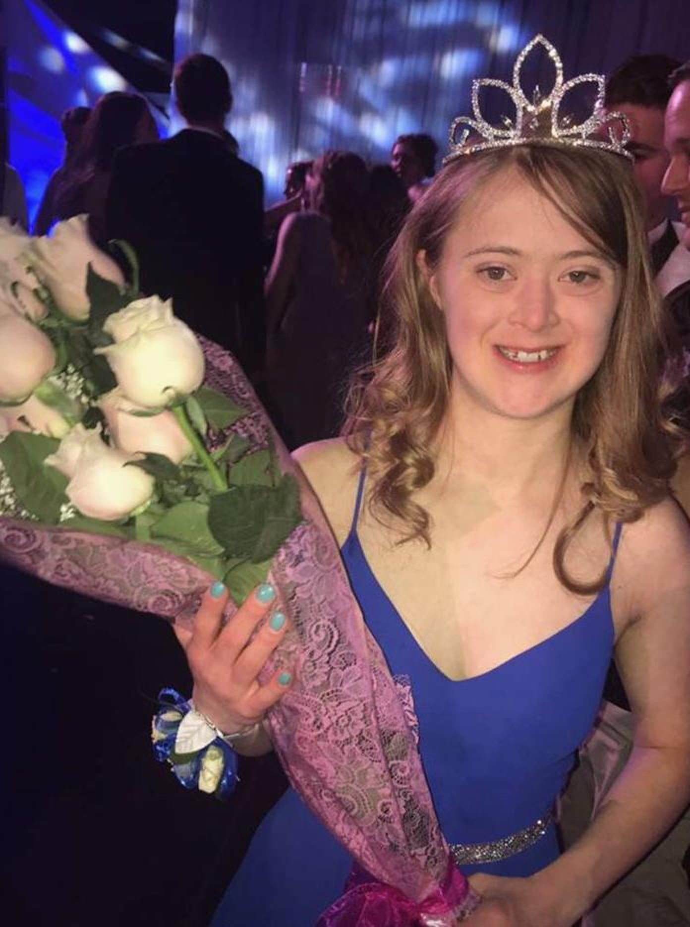 Teen With Down Syndrome Elected Prom Queen | PS Family