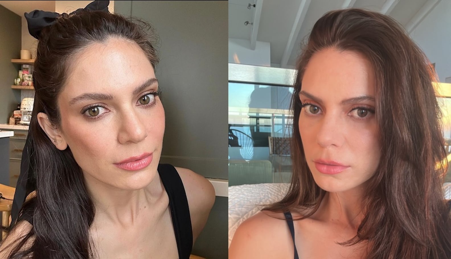 I Got a Baby Rhino, a Subtler Nose Job: See Photos | POPSUGAR Beauty