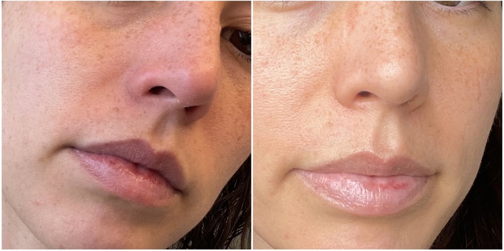 I Tried Skin Flooding: See Photos | POPSUGAR Beauty UK