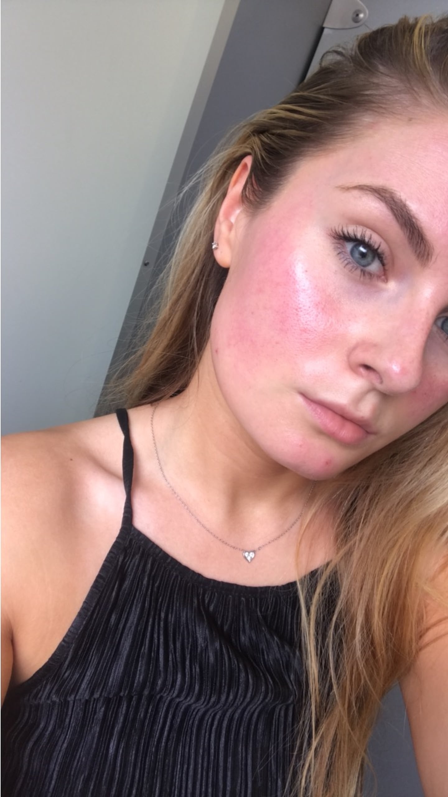 Dermaplaining Before and After Photos | PS Beauty