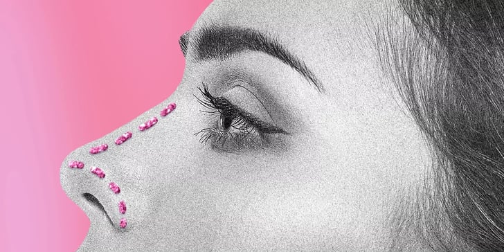 "Tip Lift" Nose Job Procedure: Recovery, Before-and-Afters | POPSUGAR ...