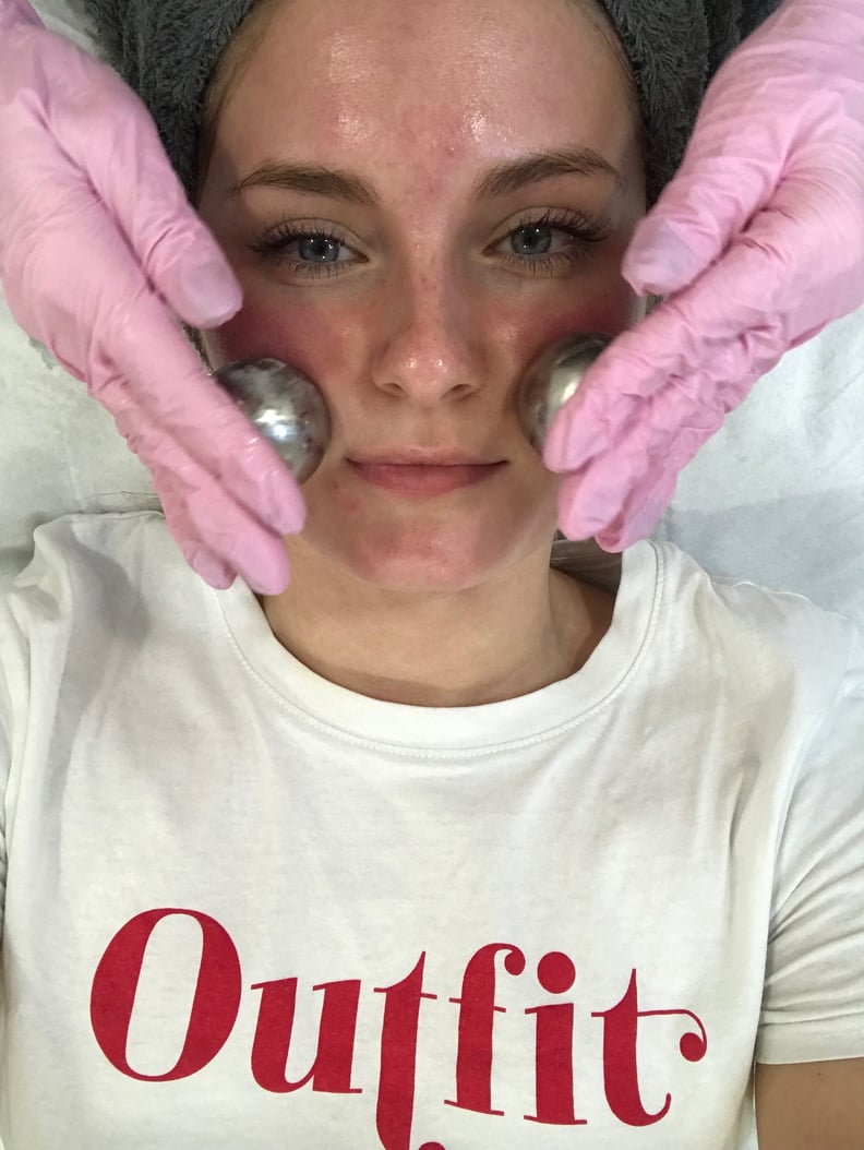 How to Treat Broken Capillaries on the Face | PS UK Beauty