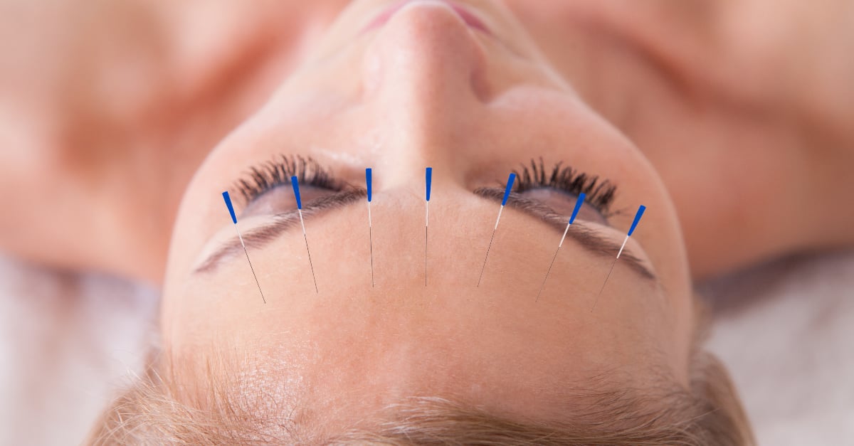 Skin Care Benefits of Acupuncture | PS Beauty